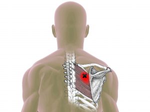 Rhomboids Trigger Points