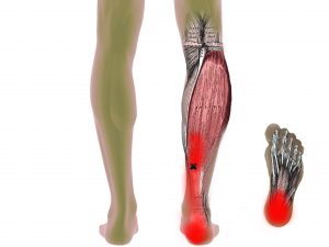 How to Treat Calf Trigger Points – Life After Pain