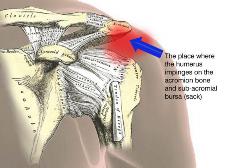 Shoulder Pain After Sleeping (and How to Prevent It) – Life After Pain