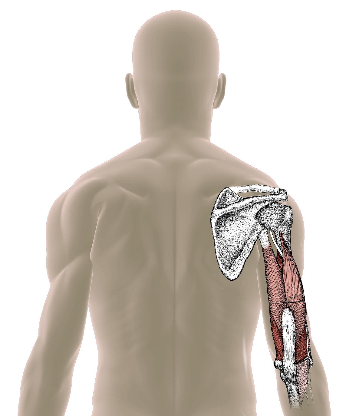 How to Rehab Triceps Tendonitis